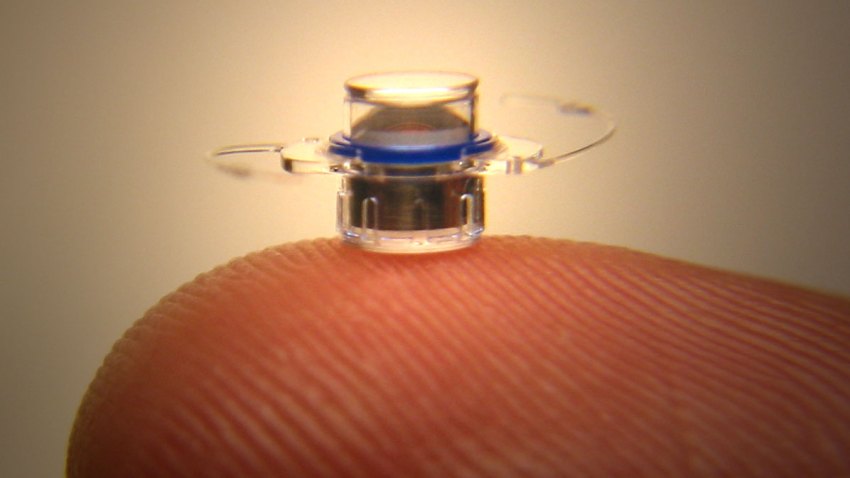 First Philadelphian to Undergo Eye Implant Surgery – NBC10 Philadelphia