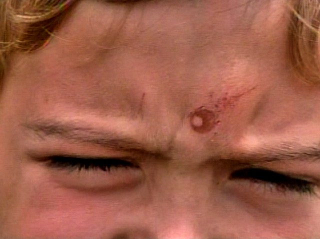 Child Wounded in Random Paintball Attack – NBC10 Philadelphia