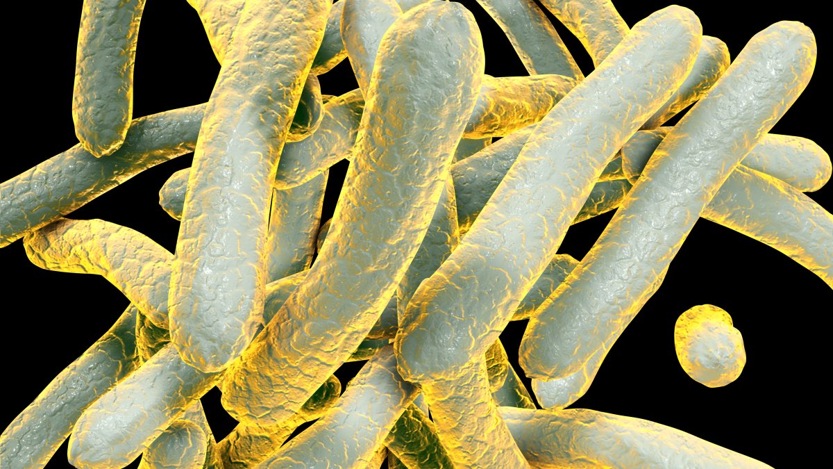 Camden County resident tests positive for TB – NBC10 Philadelphia