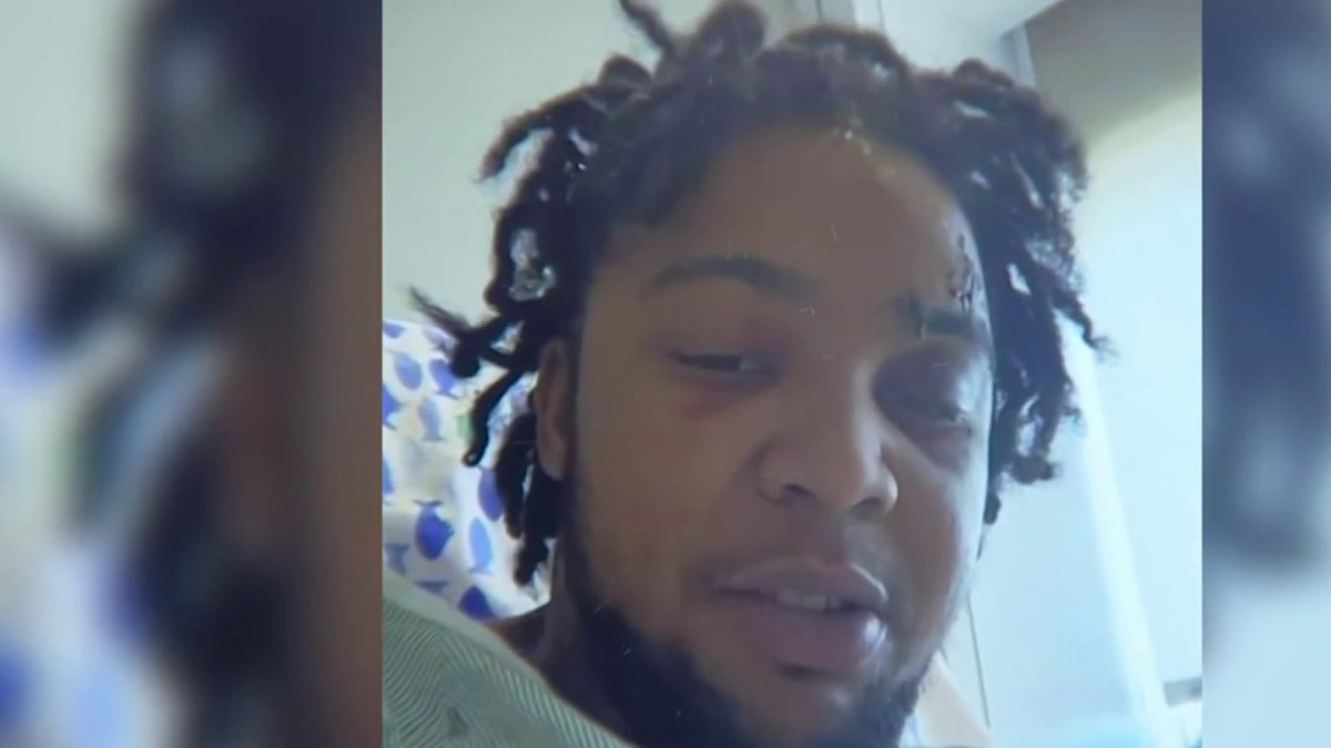NJ Hit-and-Run Victim Speaks Out as Police Search for Driver – NBC10 ...