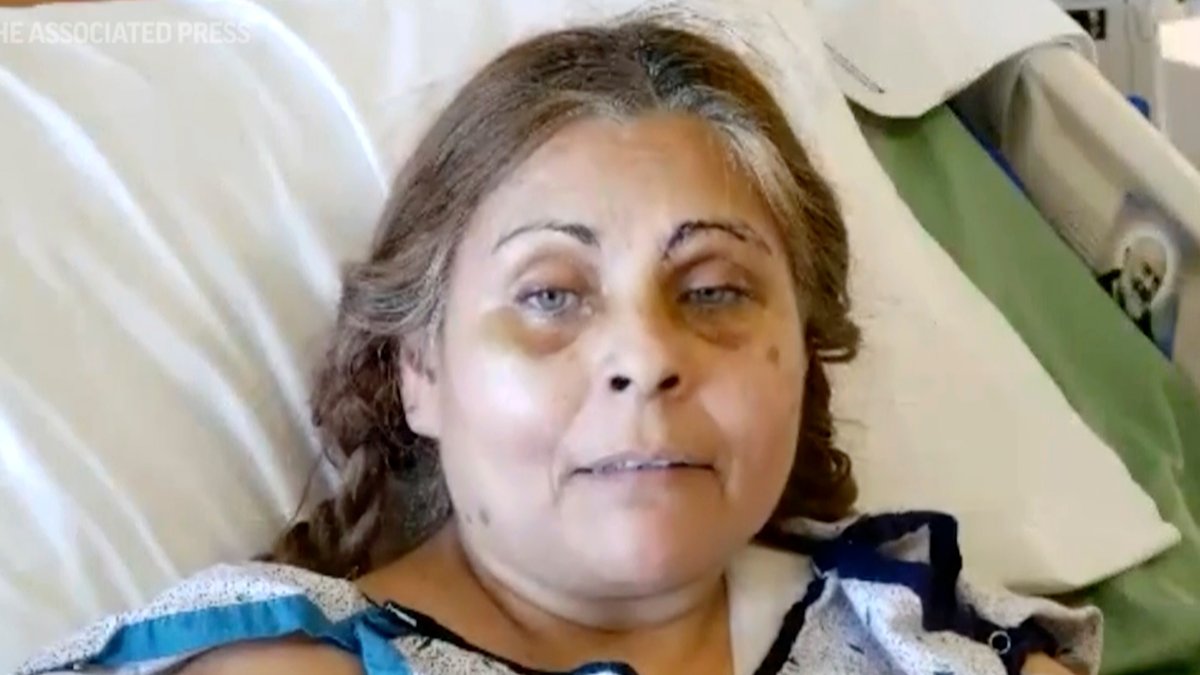 Factory Explosion Survivor, on Fire, Fell Into Chocolate Vat – NBC10 ...