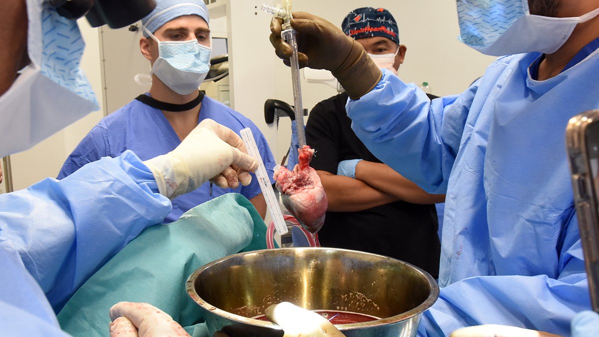 Man who received second pig heart transplant dies, hospital says ...
