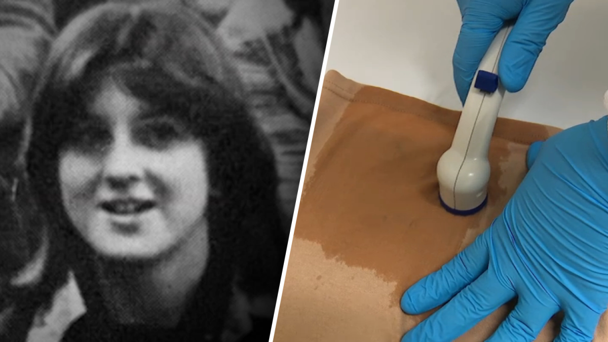 DNA collection device could help solve 1979 cold case murder – NBC10 ...