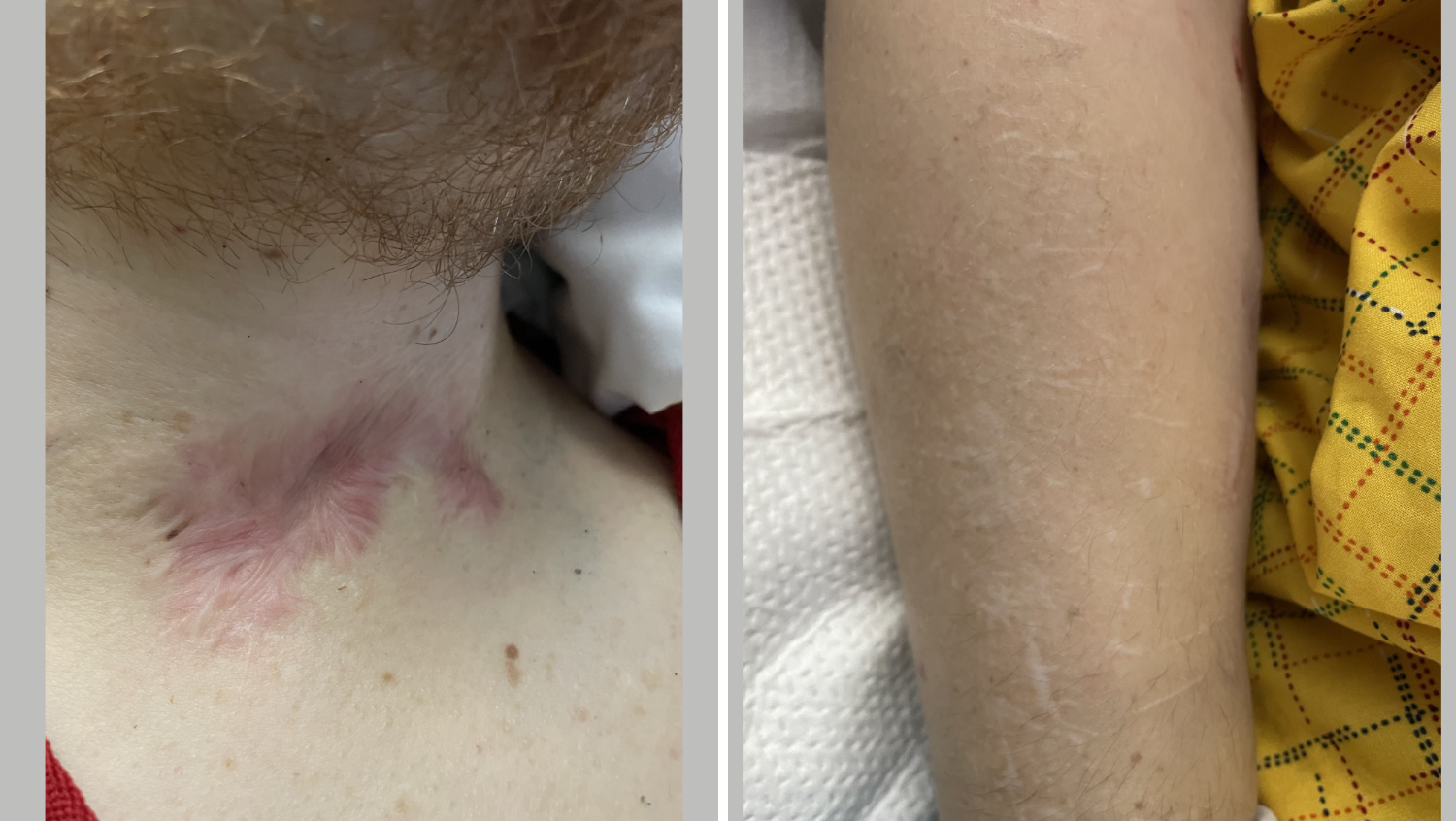 Temple Hospital sought public’s help identifying patient – NBC10 ...