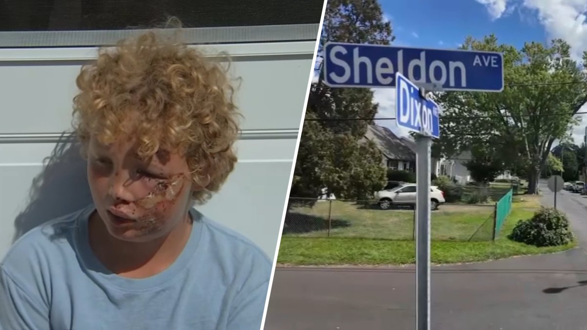 Police search for car wanted for hitting, badly hurting boy – NBC10 ...