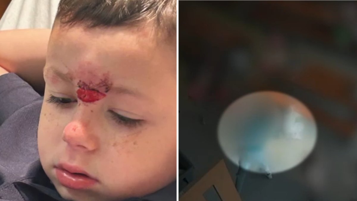 Video: Kindergartener pushed to the ground by older student – NBC10 ...
