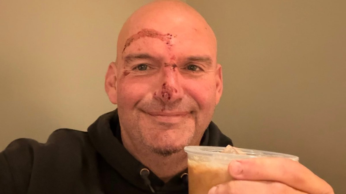 Sen. John Fetterman posts picture of injured face after fall – NBC10 ...