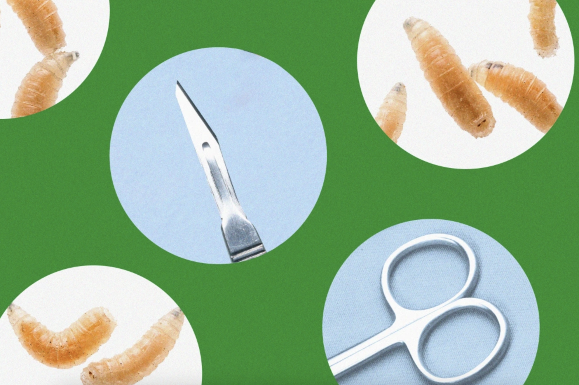 Doctors are bringing maggots into their practice on purpose – NBC10 ...
