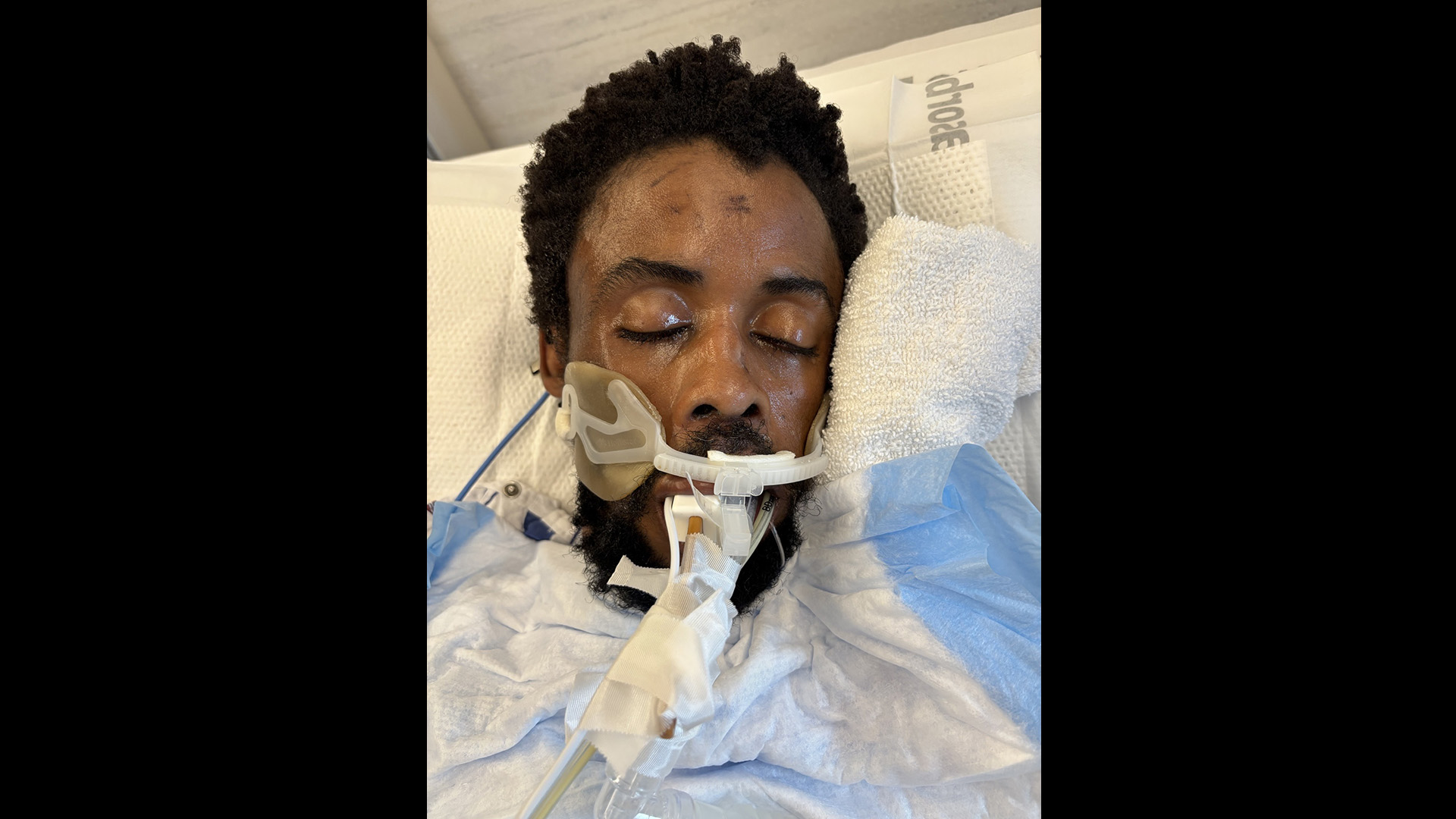 Unidentified patient at Philly-area hospital – NBC10 Philadelphia